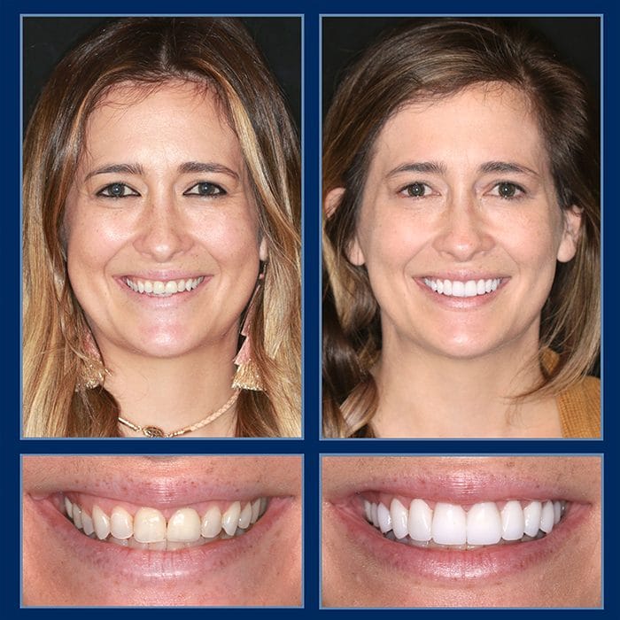 The Cosmetic Dentists Of Austin Creates Hollywood Smiles Austin Tx