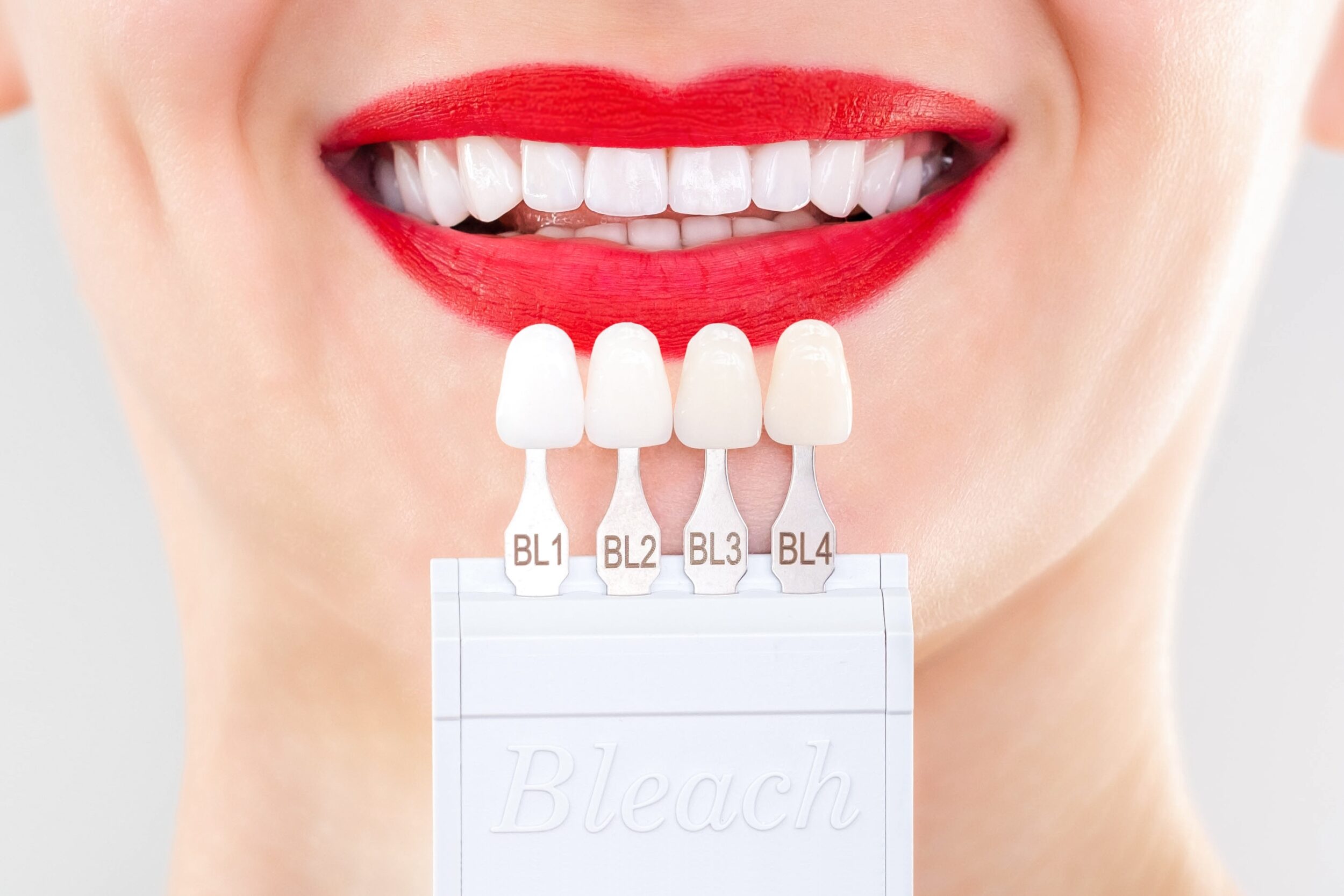 The Science Behind Porcelain Veneers - Mimic Natural Teeth